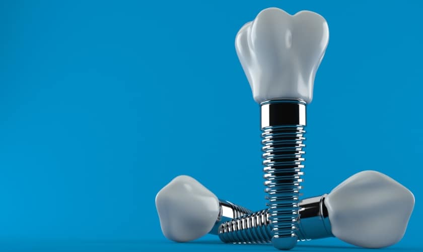 How Much Does It Cost To Remove A Dental Implant?